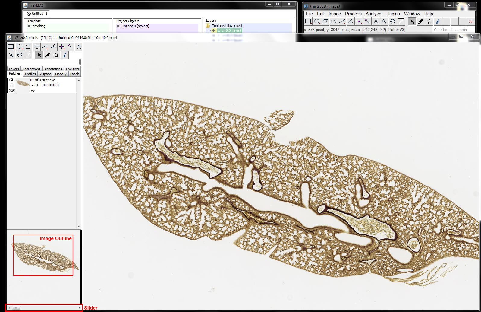 PART 5: IMAGE ALIGNMENT · Fiji Intermediate