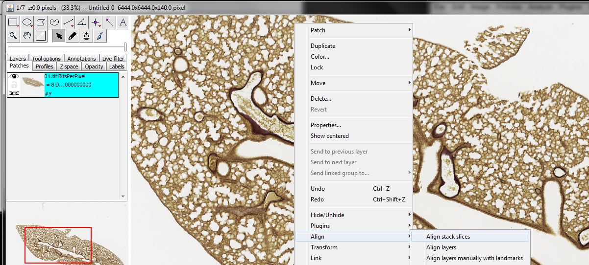 PART 5: IMAGE ALIGNMENT · Fiji Intermediate
