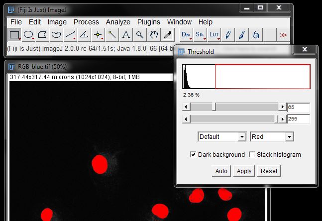 Imagej Measuring Area Measurements & Regions Of Interest · Analyzing