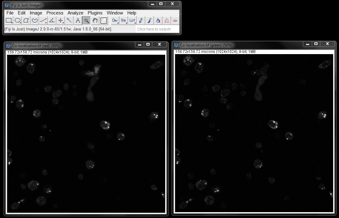 PART 9: CO-LOCALSATION ANALYSIS · Fiji Intermediate